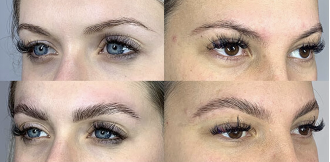 Tame & sculpt your brows with our HD eyebrow treatment | Book today ...