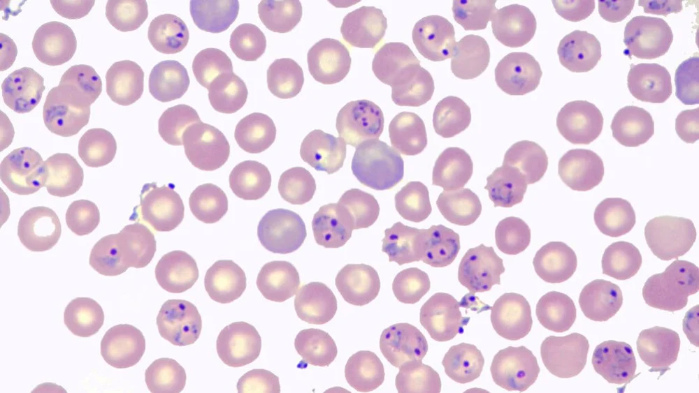How Malaria and Disease Might Make a Serious and Resurgent Comeback in ...