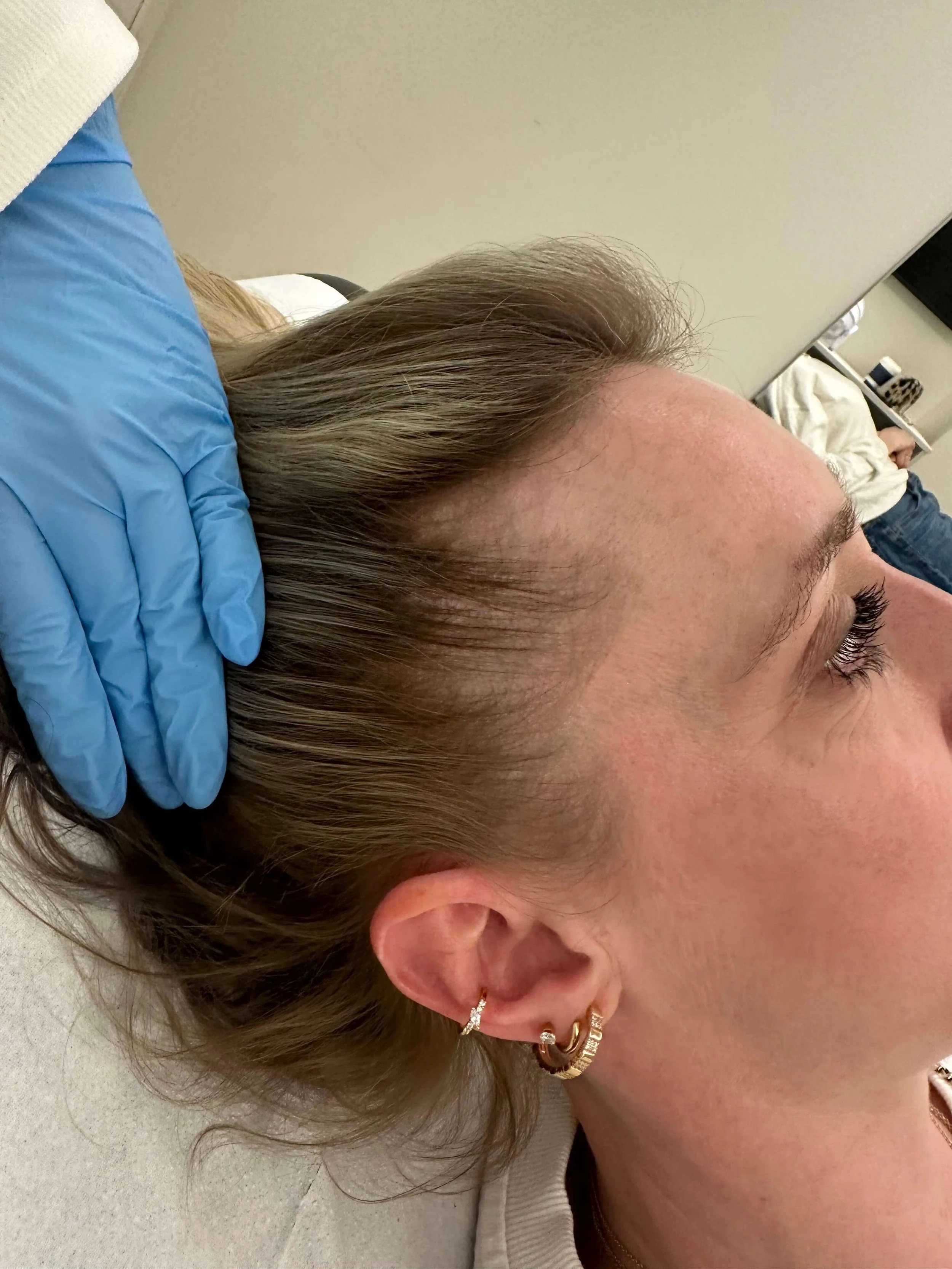 Online Trichology Consultation | Cardiff Trichologist | London ...