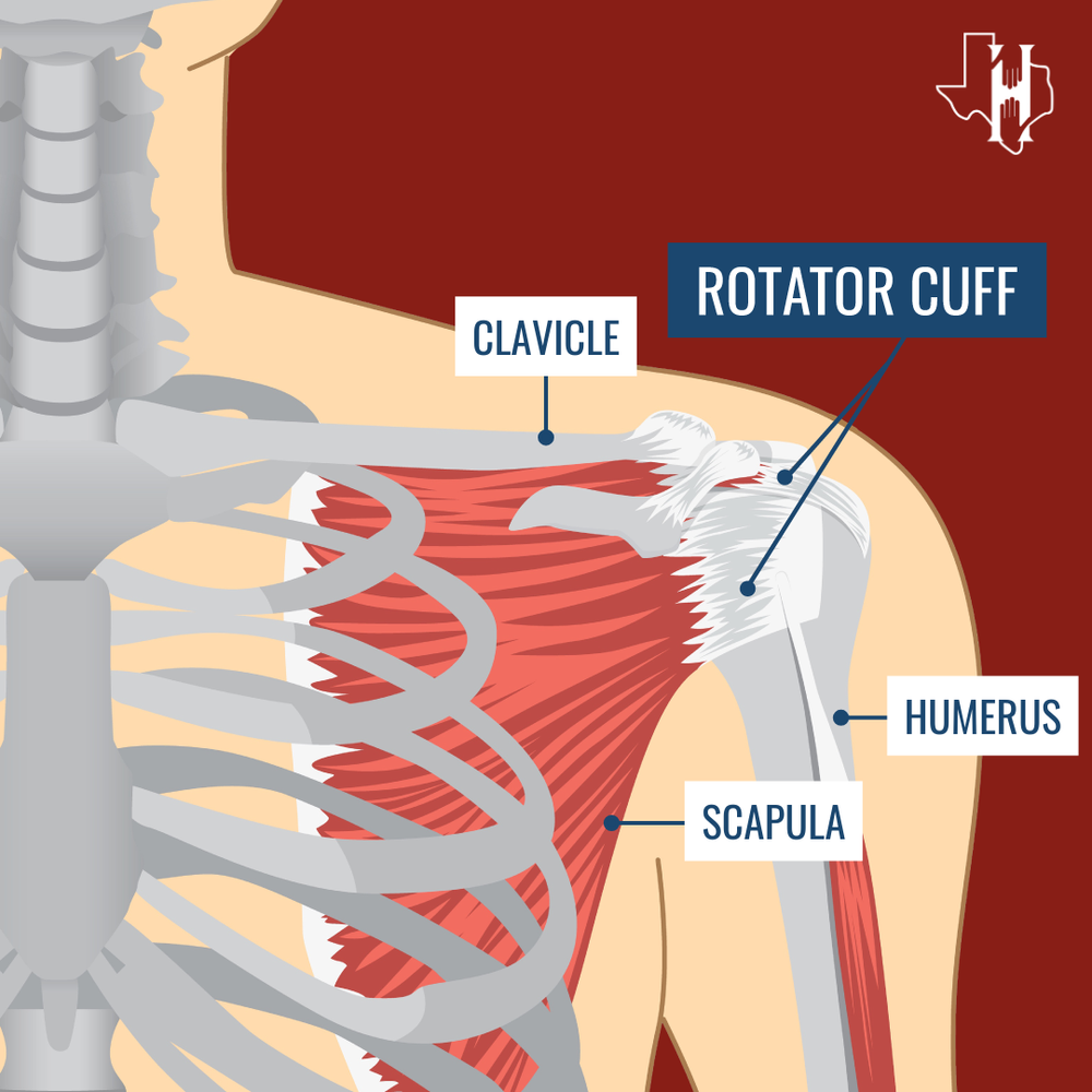 Rotator Cuff Injury Experts — Hand & Upper Extremity Center of San Antonio