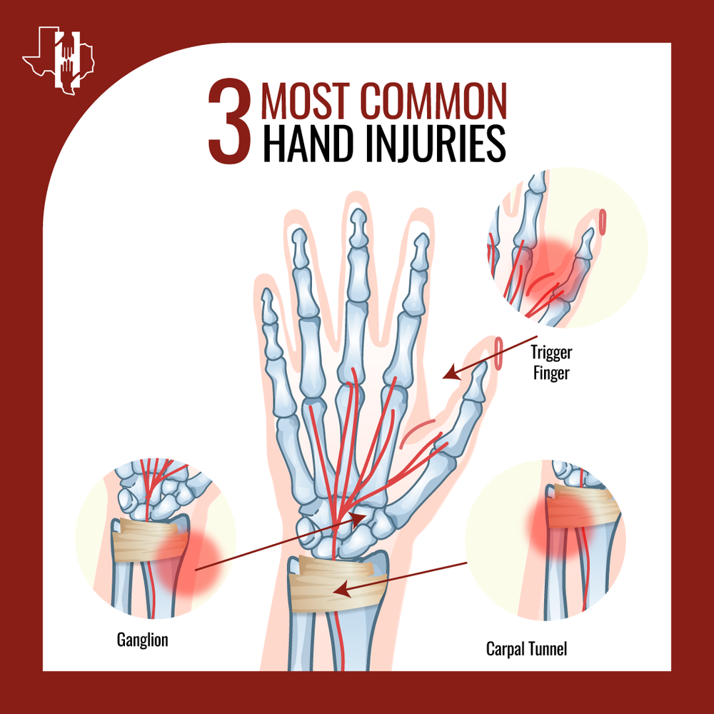 What Are The 3 Most Common Hand Injuries? — Hand & Upper Extremity Center of San Antonio