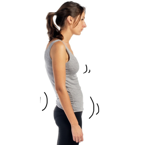 Swayback Secrets: How To Fix Sway Back Posture | FM Physio