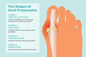 Big Toe Pain When Running? - Causes & Treatments | FM Physio