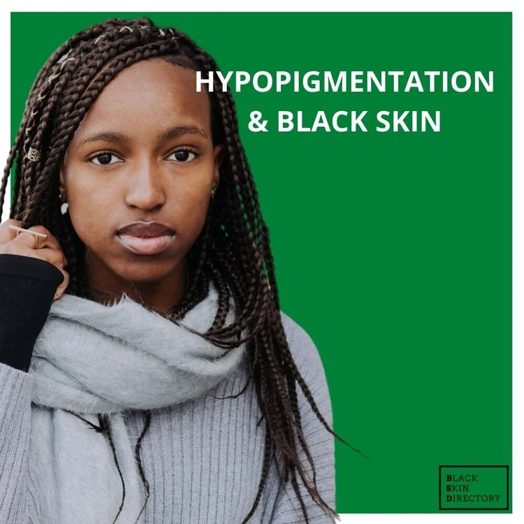 Hypopigmentation & black skin — Black Skin Directory