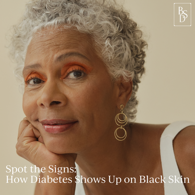 Spot the Signs: How Diabetes Shows Up on Black Skin — Black Skin Directory