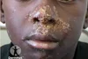 Skincare for Black Children, Babies and Toddlers — Black Skin Directory
