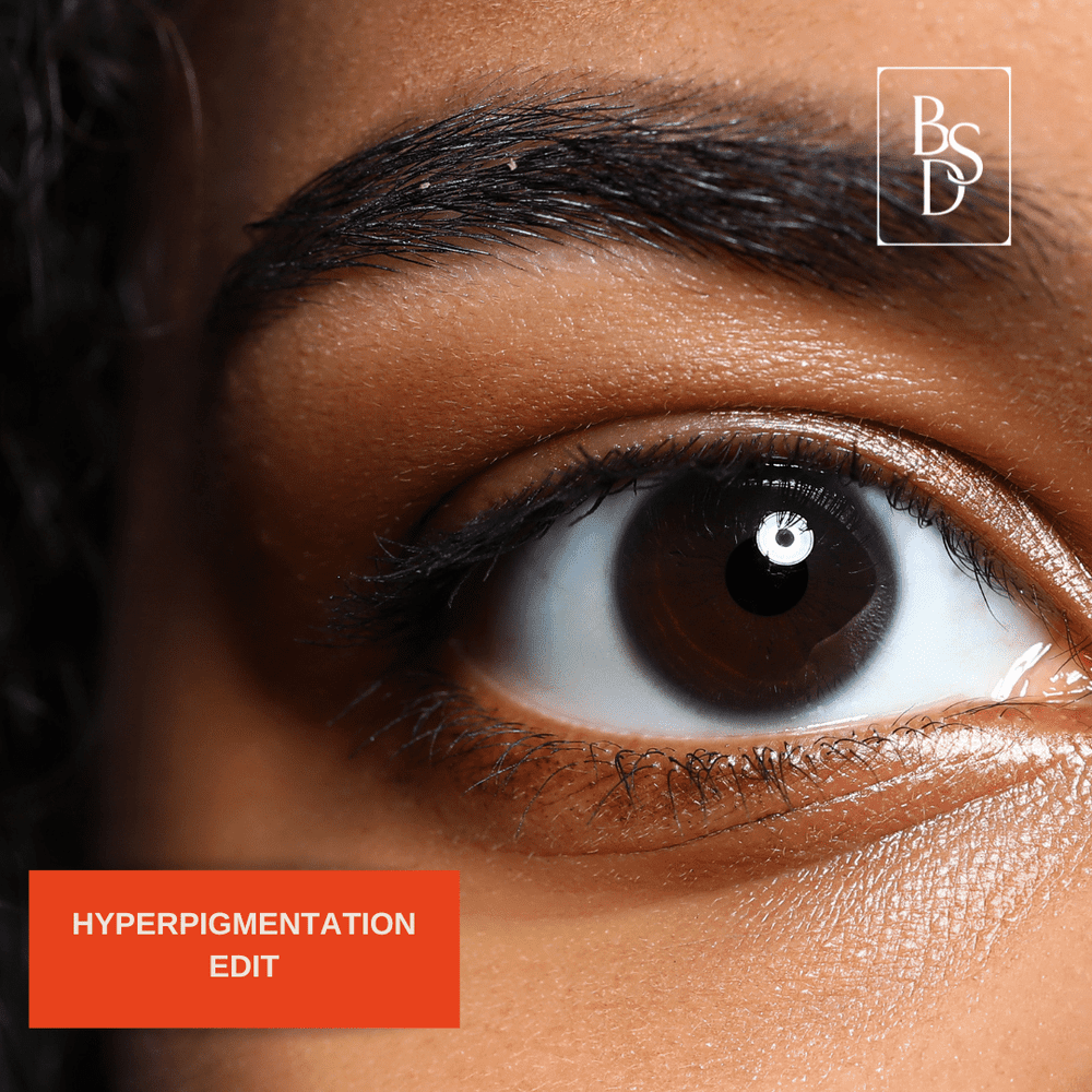 How to combat dark eye circles on Black Skin — Black Skin Directory
