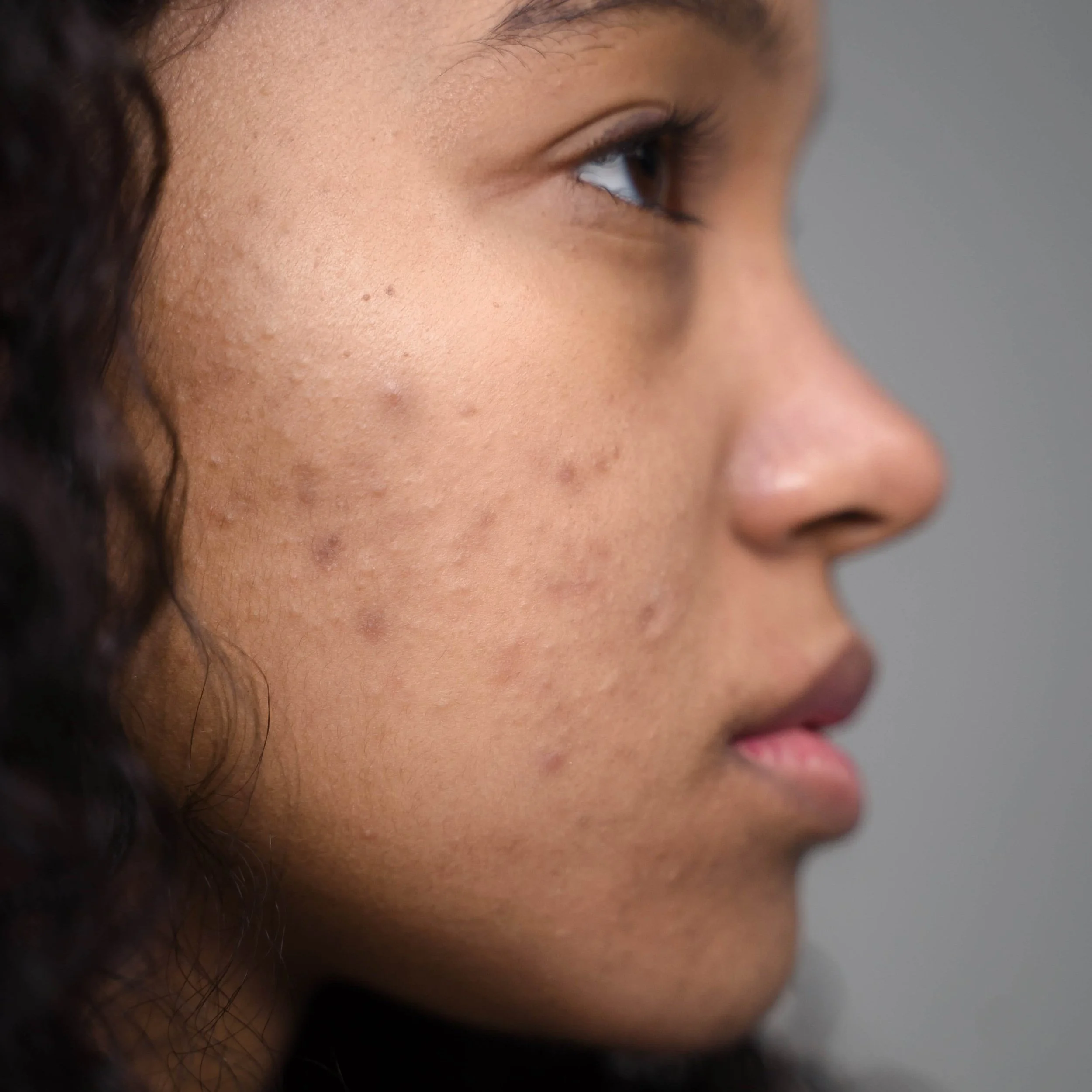 Skin Concerns — Black Skin Directory