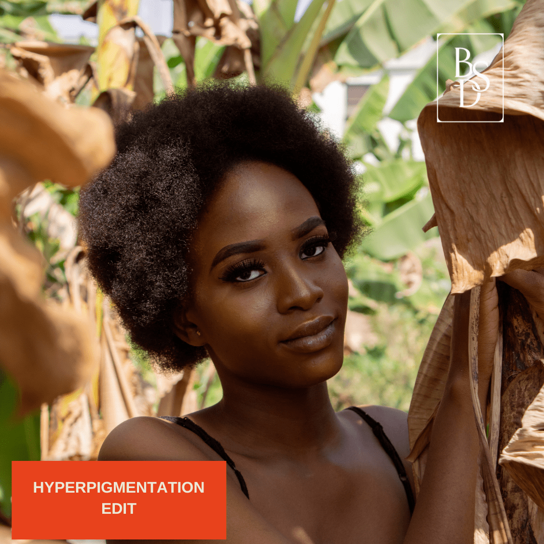 How to Treat, Prevent and Fade Hyperpigmentation — Black Skin Directory