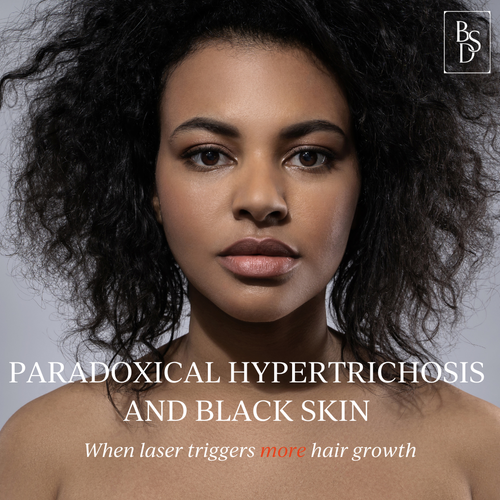 Paradoxical Hypertrichosis and Black skin - When laser triggers more ...