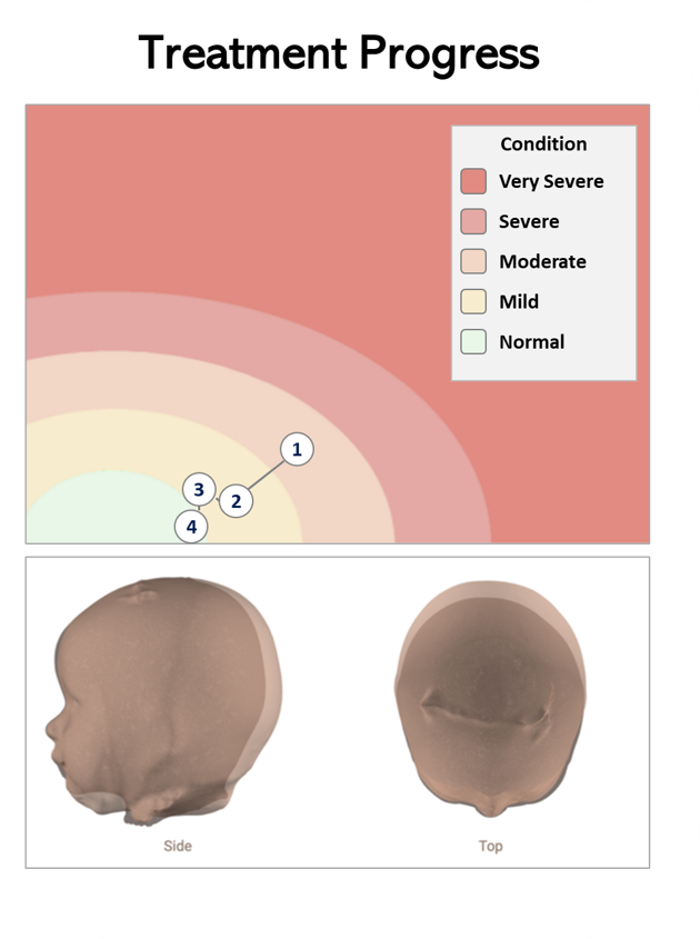 Sano Orthotics - Give your child a Head start!