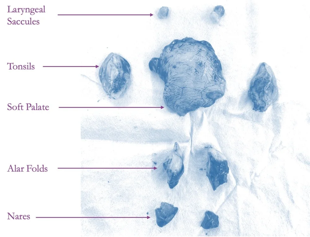 Corrective Airway Surgery — Dr Melissa Kozaruk