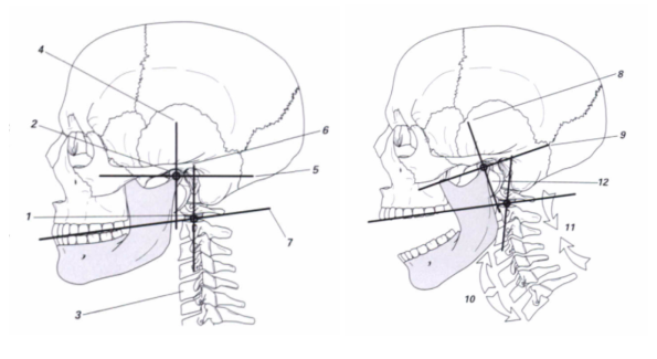 Jaw Pain Demystified: Tracing the Origins from Your Upper Cervical ...