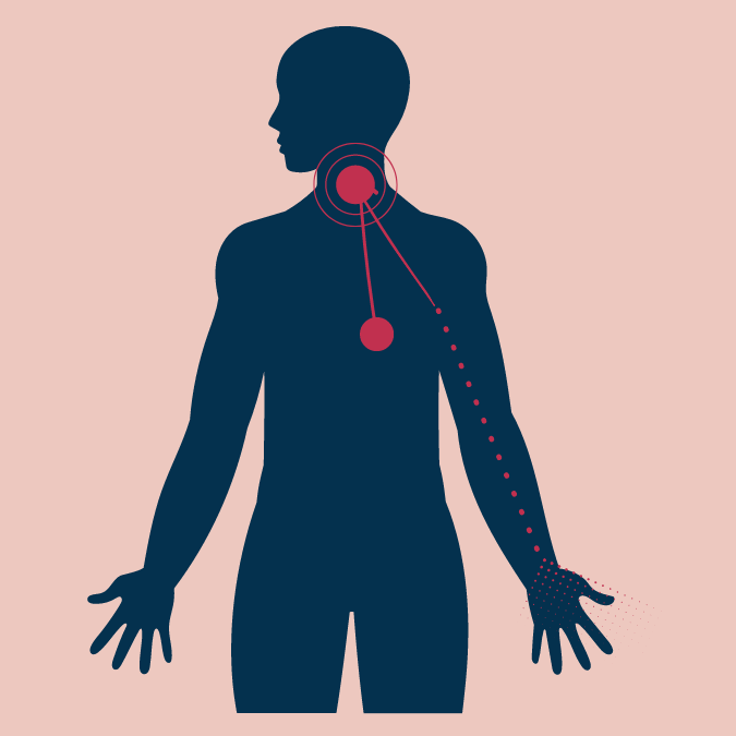 The Surprising Impact of Neck Pain on Your Overall Health — KOEO