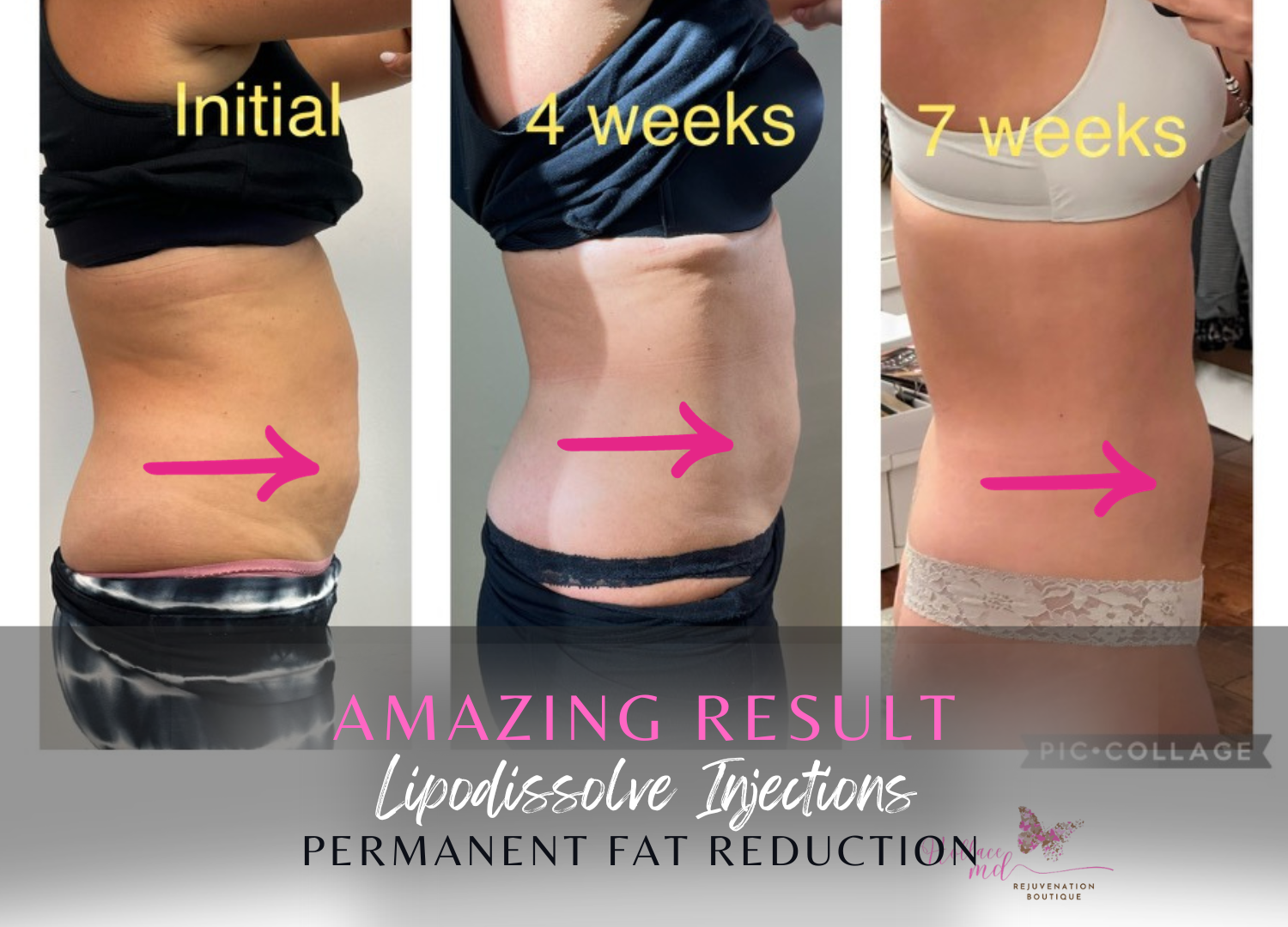 HollaceMD Advanced Laser + Aesthetics