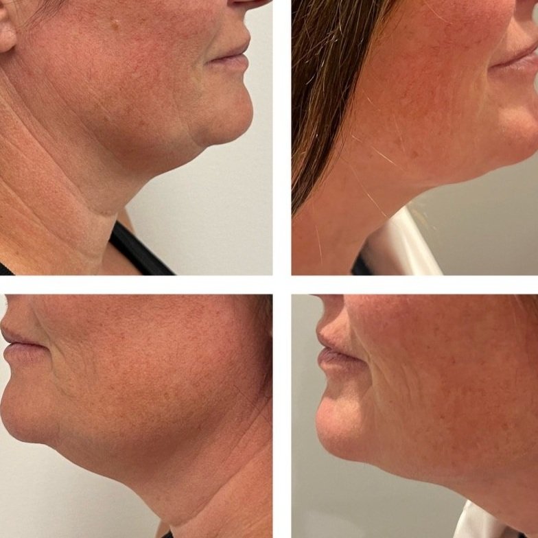 HollaceMD Advanced Laser + Aesthetics