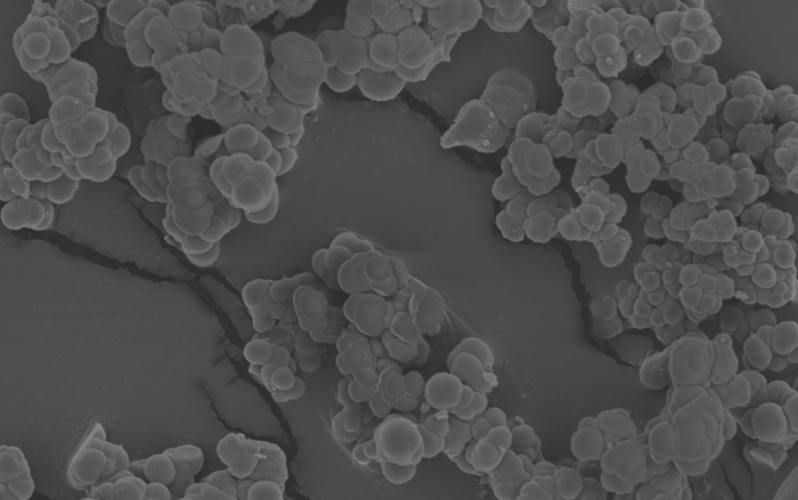 Molecularly Imprinted Polymers — amaea
