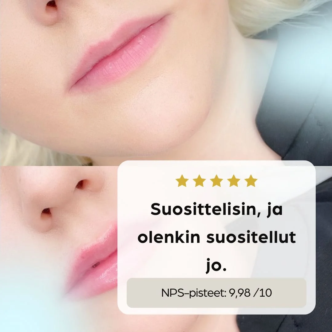 BOTOX- ja täyteainehoidot Helsinki | Ebeling Kauneus