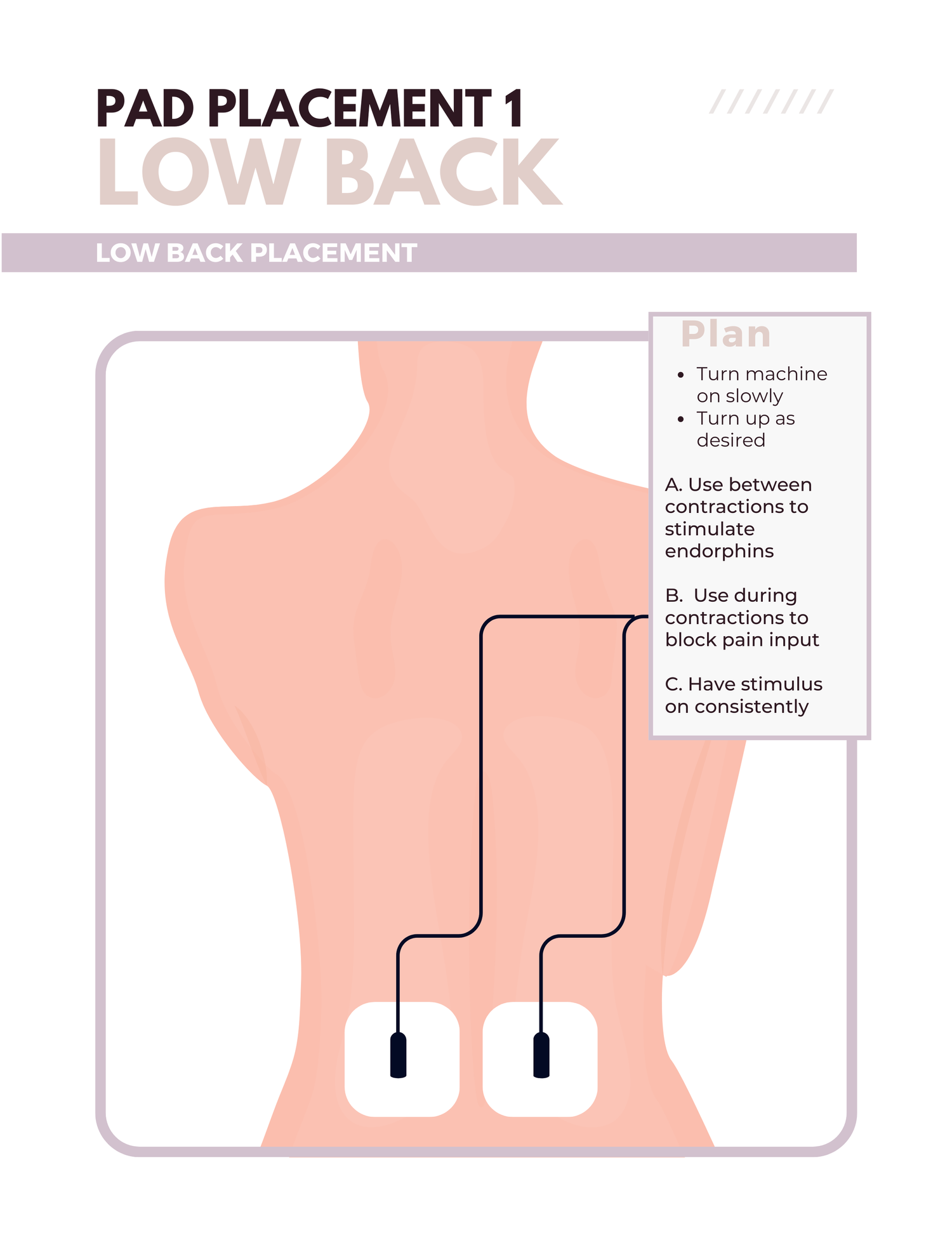 TENS machine in labour for pregnant parents and doulas — Doula Services ...