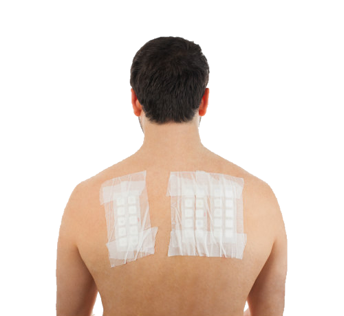 Patch Testing for Allergic Contact Dermatitis in Katy & Memorial Houston