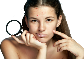 Accutane Instructions