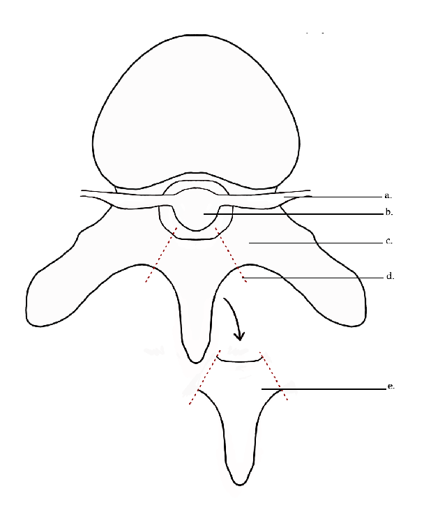 Anatomy of Your Vertebrae After Surgery, by Madison Frazier — Barrelhouse