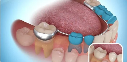 Space Maintainers — Flossy Mountain