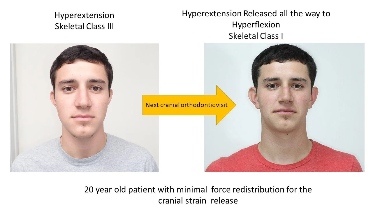 About 5 — Cranial Orthodontics