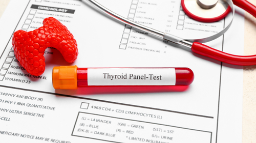Drugs That Affect Thyroid Function Tests: Causes, Examples, and ...