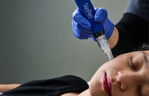 Skin Booster Injection | Skin Booster Treatment — Athena Dermatology Clinic