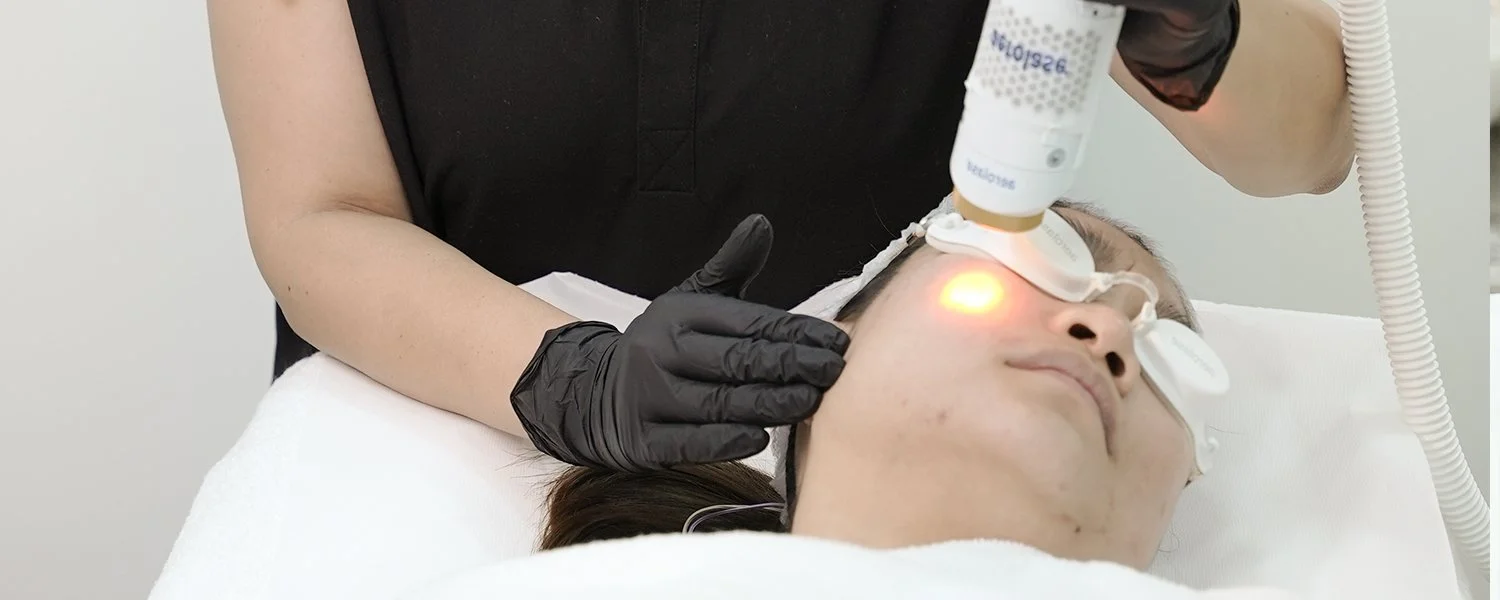 Aerolase Neo Laser Treatment in Dubai - Athena Clinic — Athena ...
