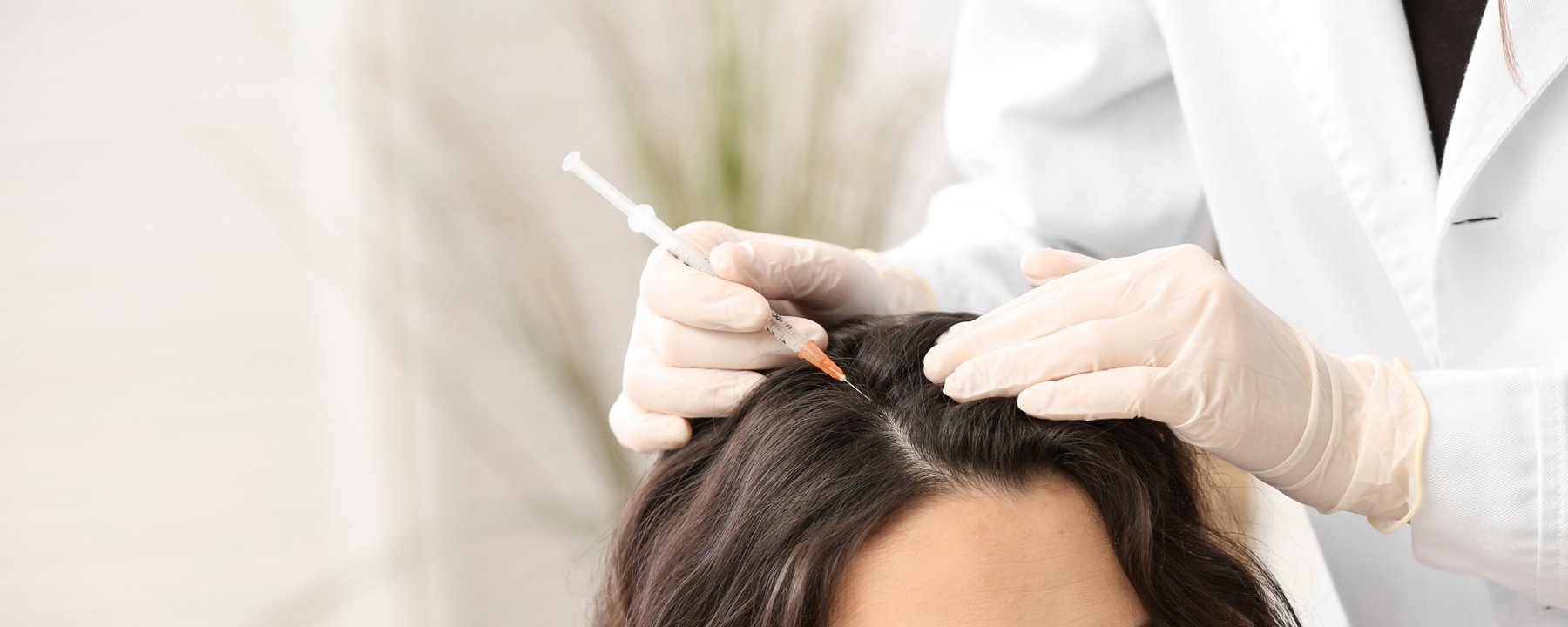 Combination Therapy for Hair Loss — Athena Dermatology Clinic