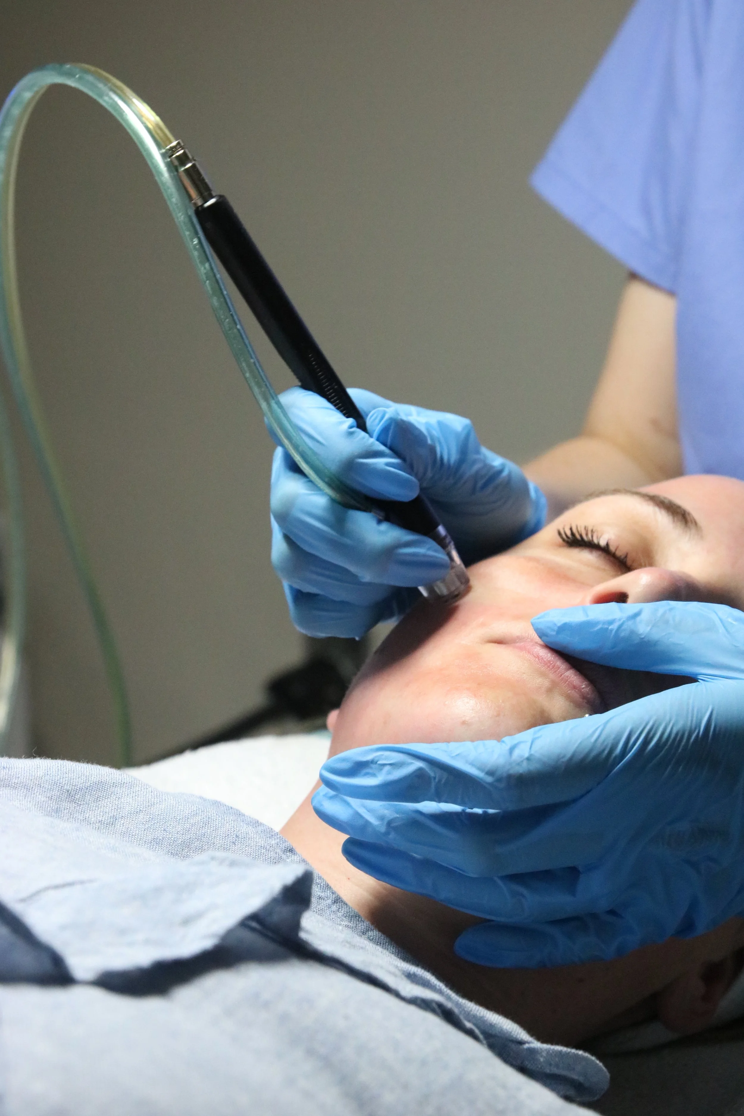 SilkPeel DermalInfusion™ | HydraFacial | DiamondGlow ...