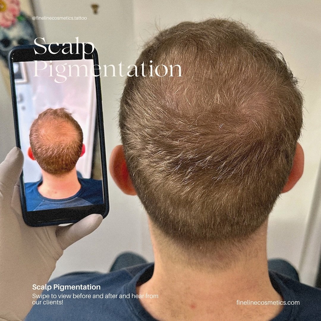 Gallery — Fine Line Cosmetics & Tattoo