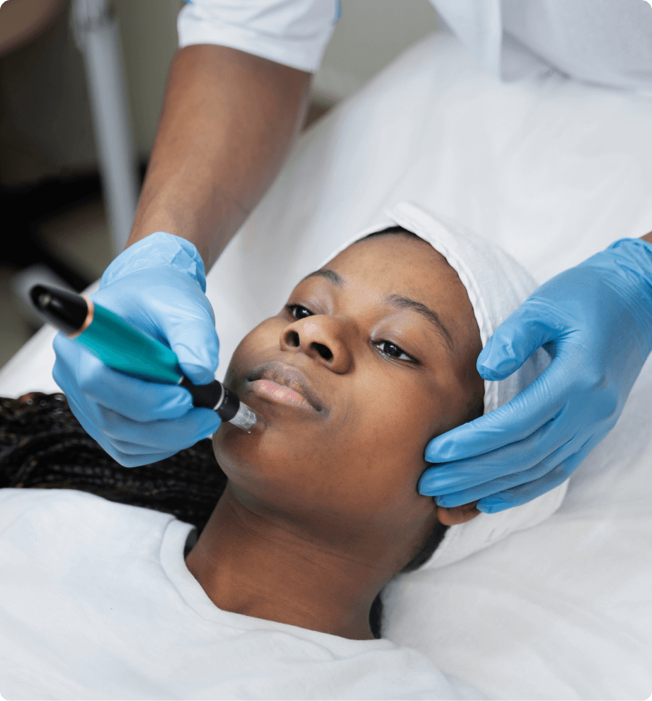 Microneedling RF in Dothan, AL | Luxe Esthetic Studio