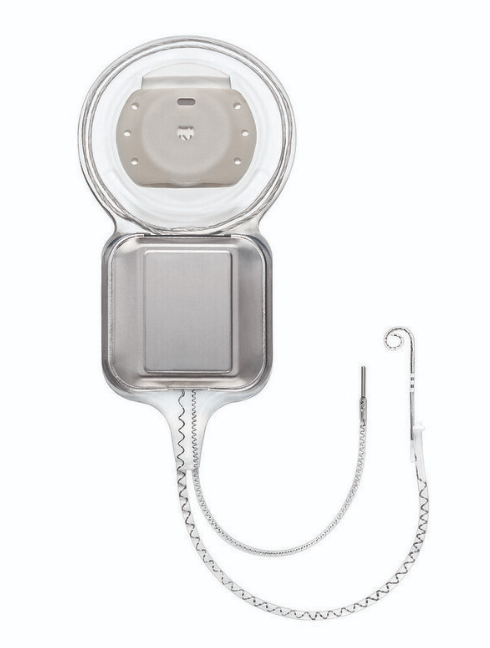 How Cochlear Implants Work — Appalachian Audiology