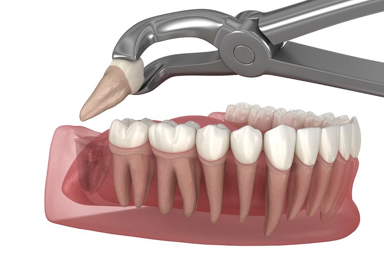 Oral & Maxillofacial Surgery — Dr Timothy Manzie | Maxillofacial ...