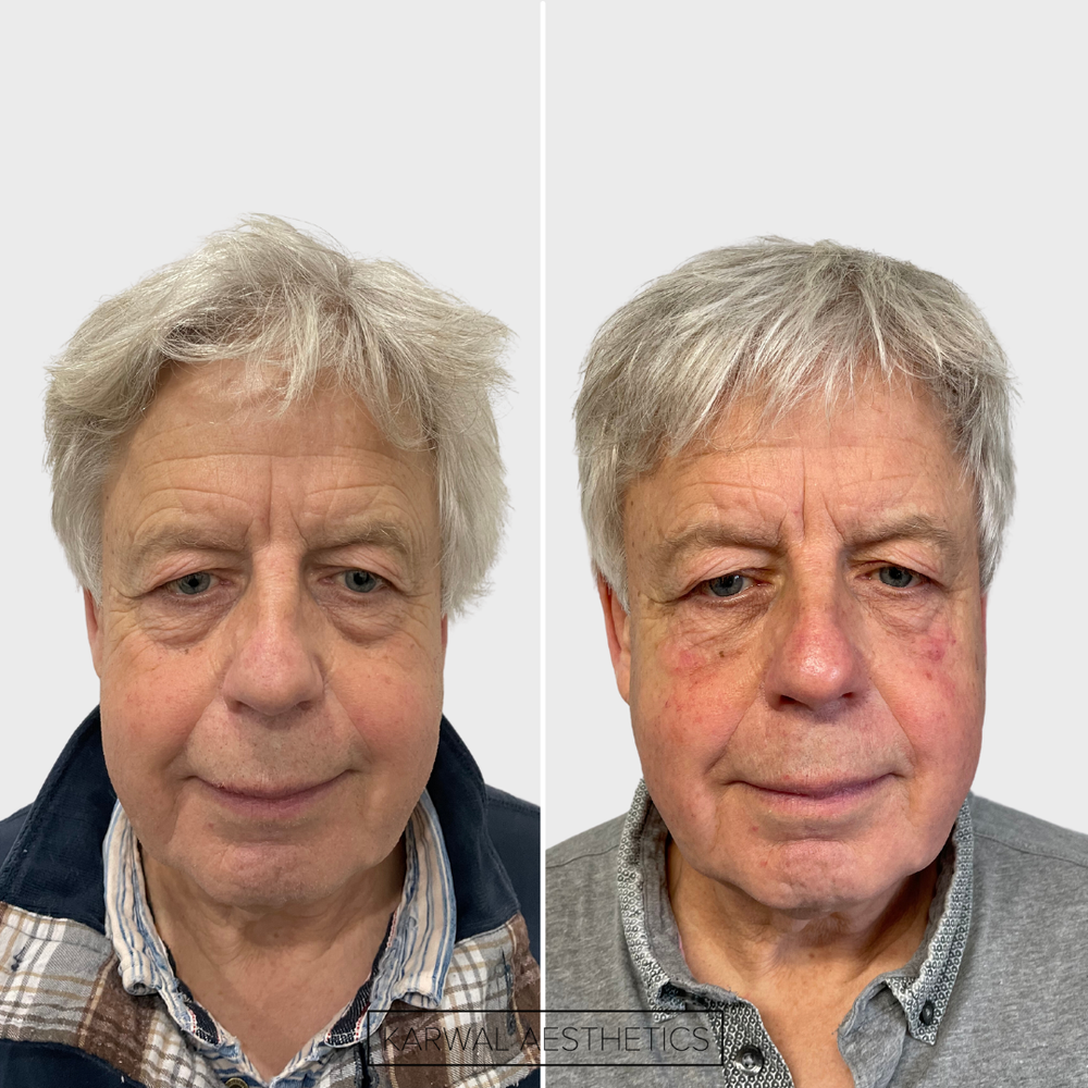 Become a model — Karwal Aesthetics