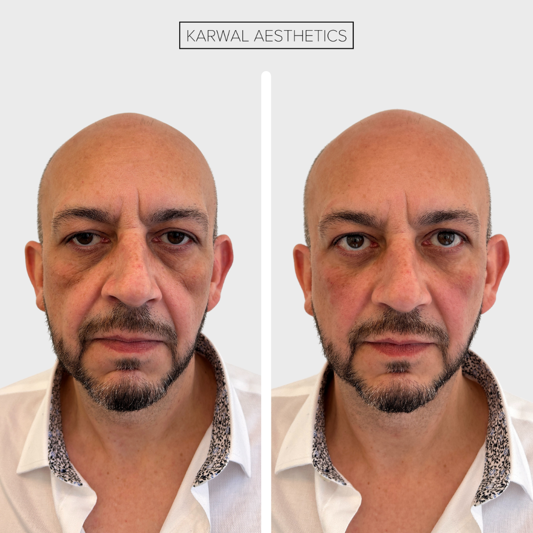 Become a model — Karwal Aesthetics