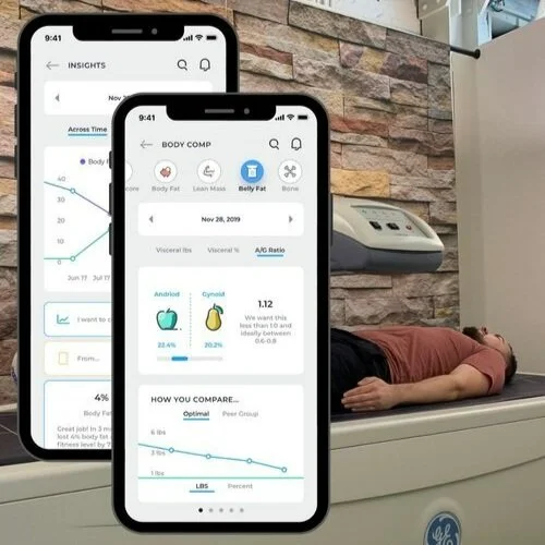 DEXA Scan — Longevity | powered by DexaFit