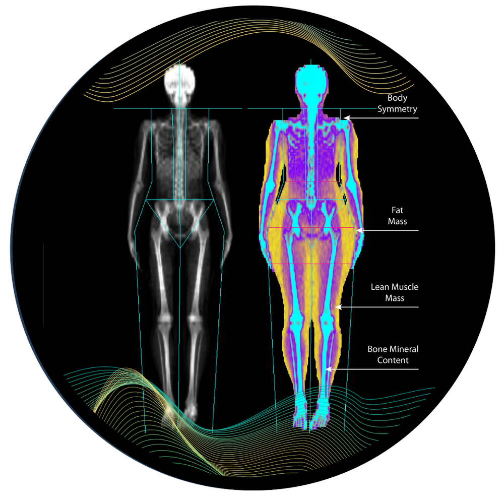 DEXA Scan Westport, Greenwich & Stamford — Longevity Westport | by DexaFit
