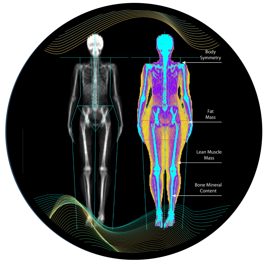 DEXA Scan Westport, Greenwich & Stamford — Longevity Westport | by DexaFit