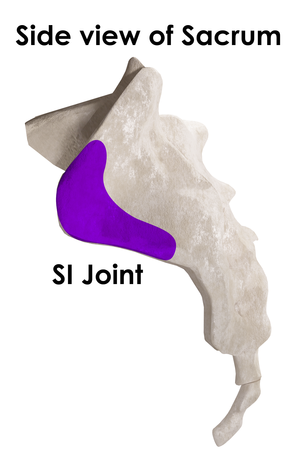 SI Joint dysfunction — Aurora - Simplifying The Complex - Spine and ...