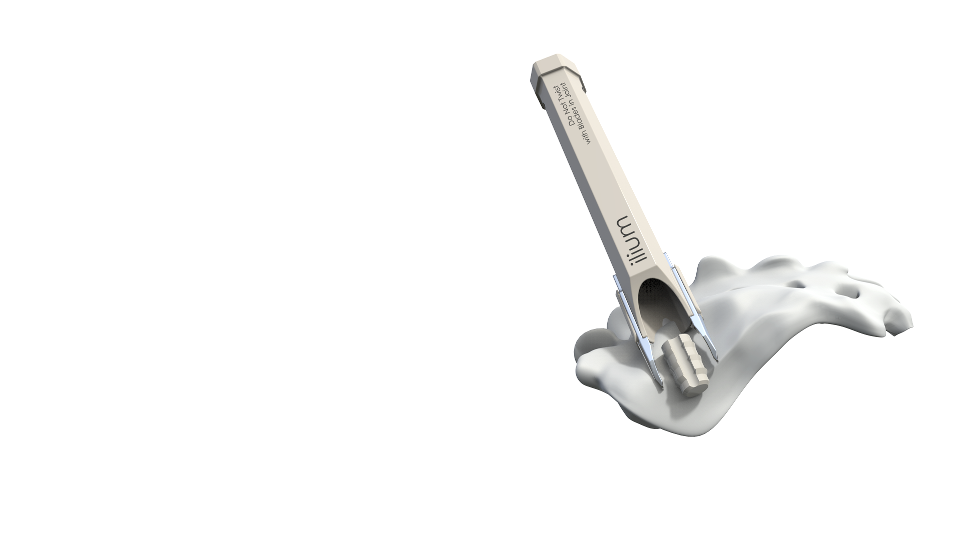 SiLO™ Allograft - Sacroiliac Joint Fusion — Aurora - Simplifying The ...