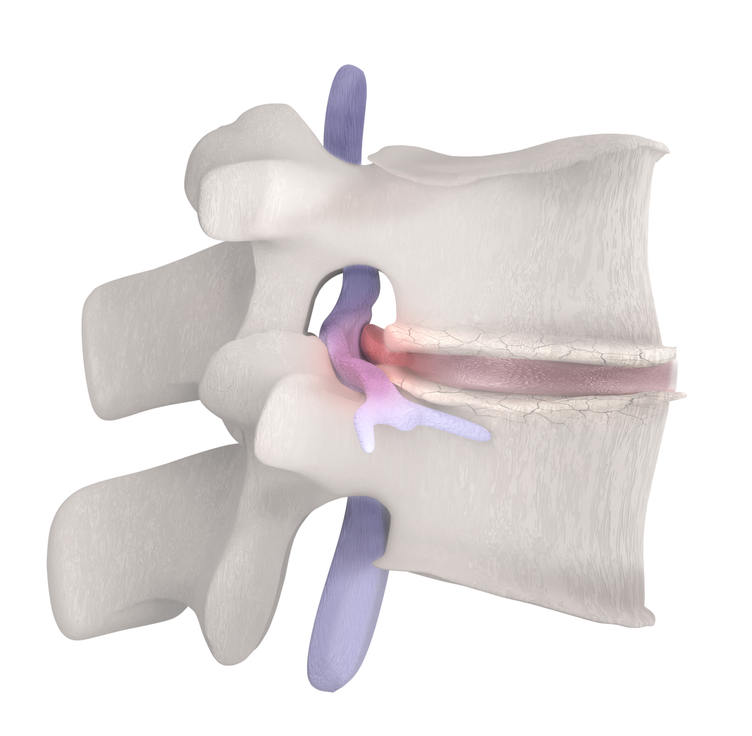 Back Pain — Aurora - Simplifying The Complex - Spine and Pain Solutions