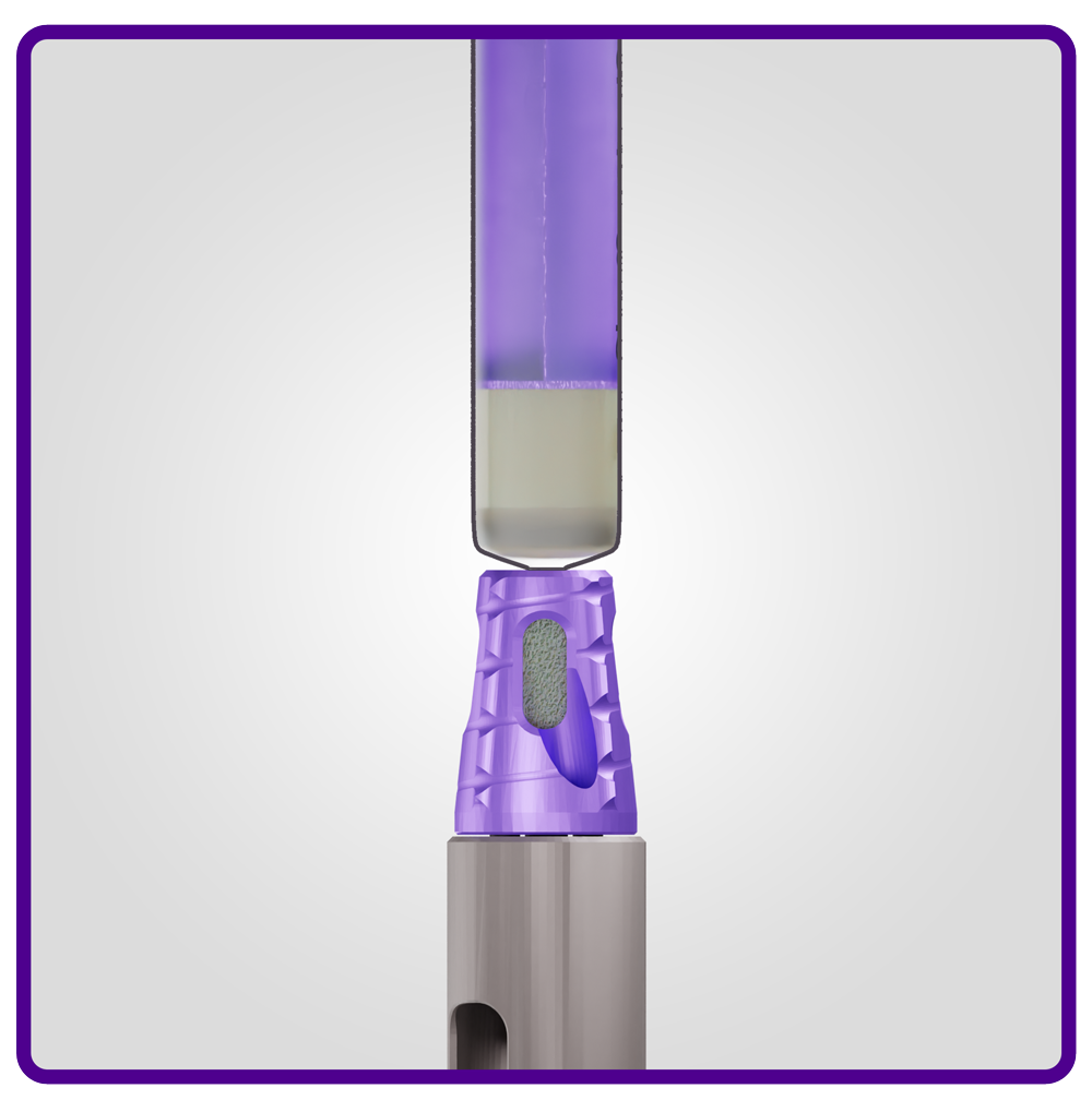 SiLO TFX™ - Transfixing The SI Joint — Aurora - Simplifying The Complex ...