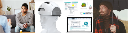 qEEG Brain Mapping Assessment — Brain Care Psychology and Neurotherapy ...