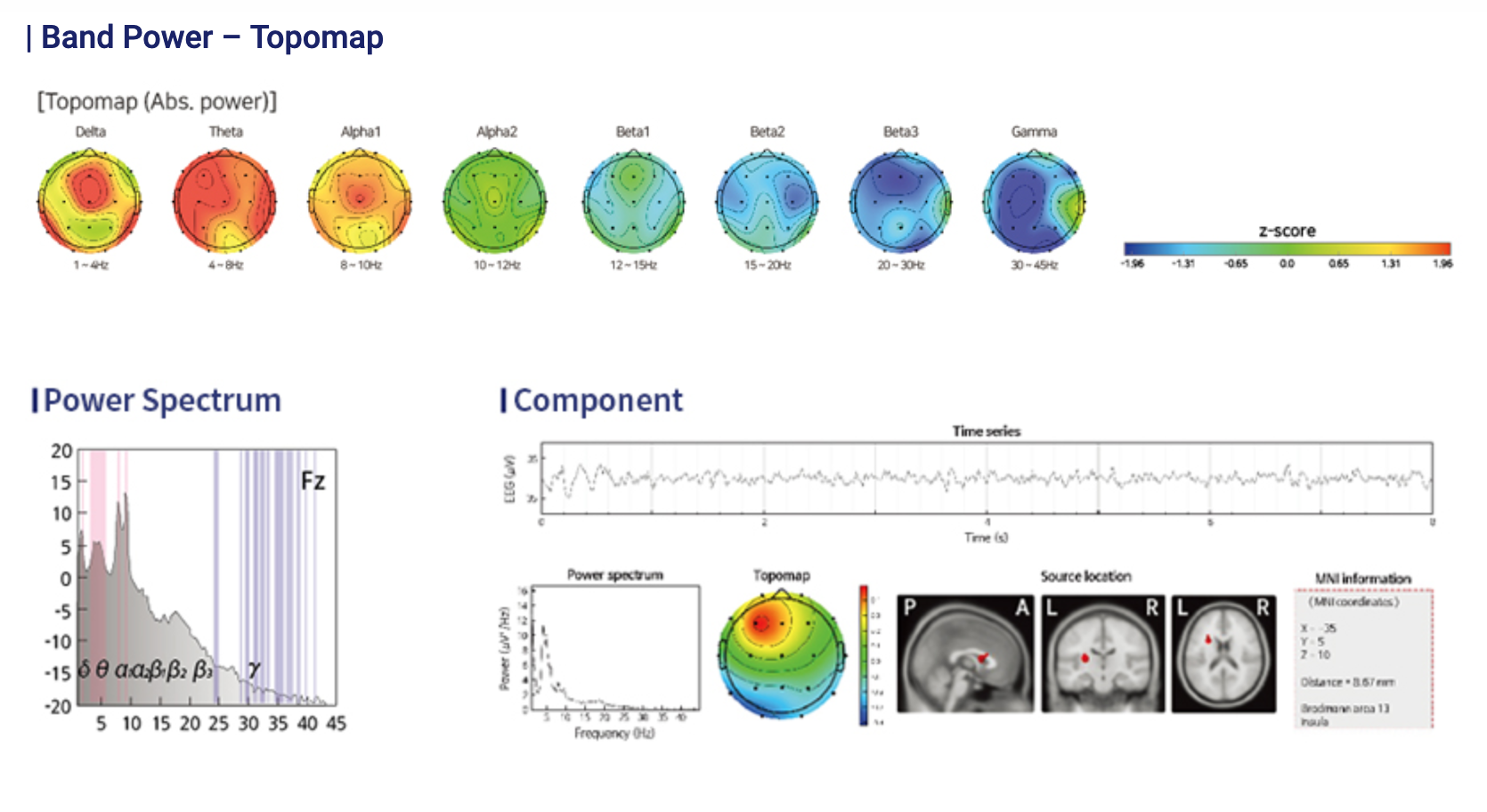 qEEG Brain Mapping Assessment — Brain Care Psychology and Neurotherapy ...