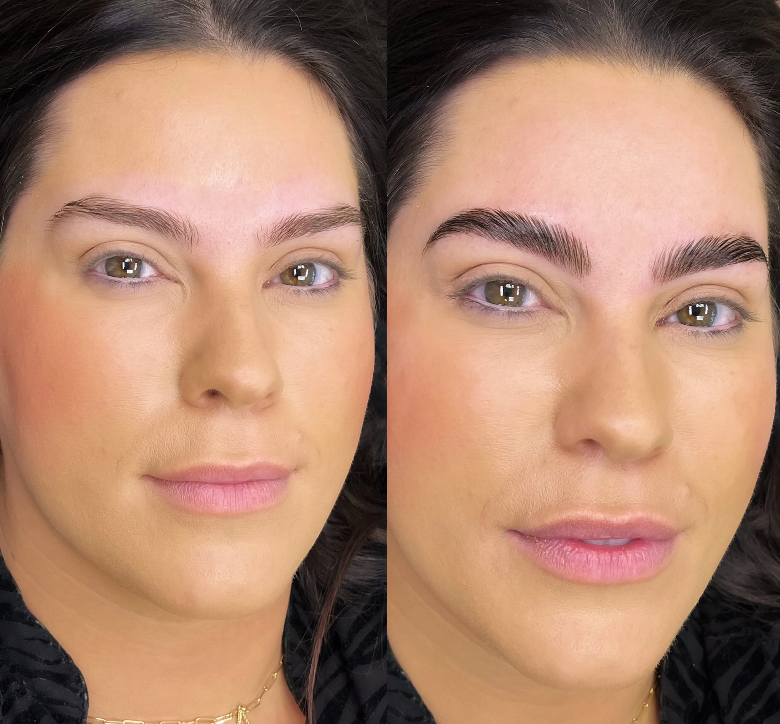 OUR WORK — Calypso Aesthetic Lab