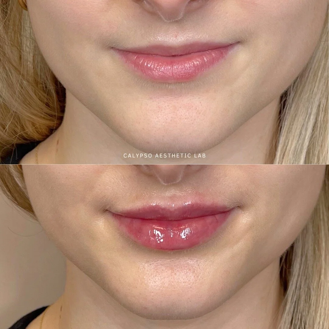 CONTACT US — Calypso Aesthetic Lab